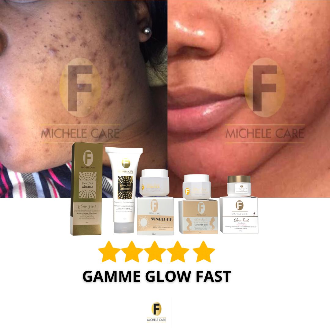 Gamme anti-acné - Glow Fast – michele-care